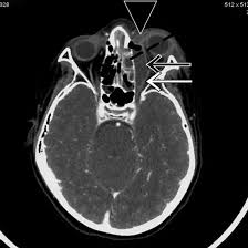 CECT Orbit Axial | Medifyhome