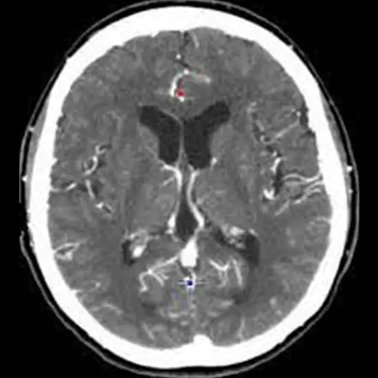CT Head Plain and Contrast | Medifyhome