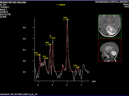 MRI Scan For Spectroscopy | Medifyhome