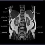 MRI Abdomen With Contrast | Affordable price | Medifyhome