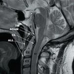 MRI Scan For Brain With CV Junction | Medifyhome