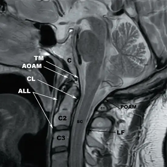 MRI Scan For Brain With CV Junction | Medifyhome