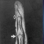 MRI Index Finger | Test and Scan | Medifyhome