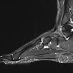 MRI Scan For Left Foot | Medifyhome