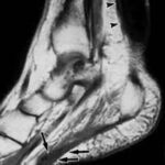 MRI Scan For Left Heel | Medifyhome