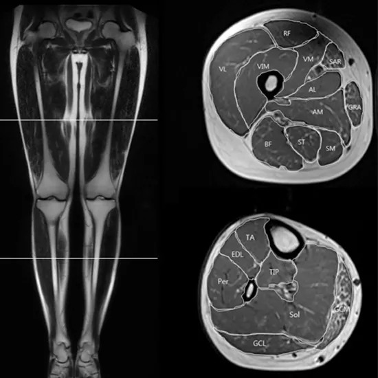 MRI Lower Limb | Starts from Rs.8000/- | Medifyhome