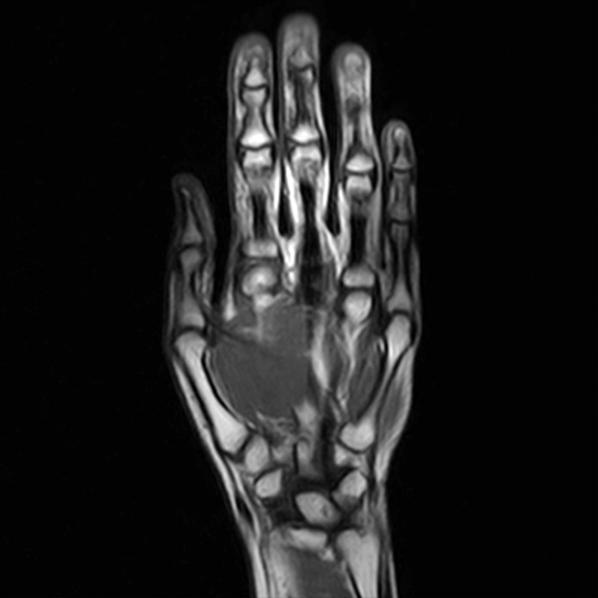 MRI Palm | Reasonable rate | Medifyhome