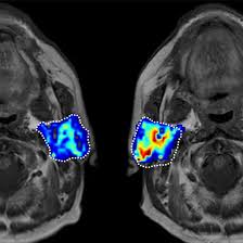 MRI Parotid Gland With Contrast | Starts from Rs. 4000 | Medifyhome