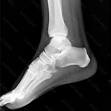 MRI For Right Foot | Medifyhome