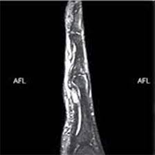 MRI Right Middle Finger | Test cost | Medifyhome
