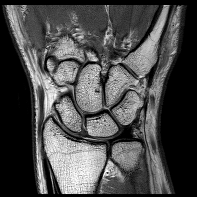MRI Right Wrist | Affordable price | Medifyhome