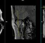 MRI TM (Temporo-Mandibular) Joint Right | Medifyhome