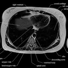 MRI Thorax | Test cost | Medifyhome