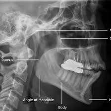 X-Ray Maxilla Lateral View | Book Now | Medifyhome